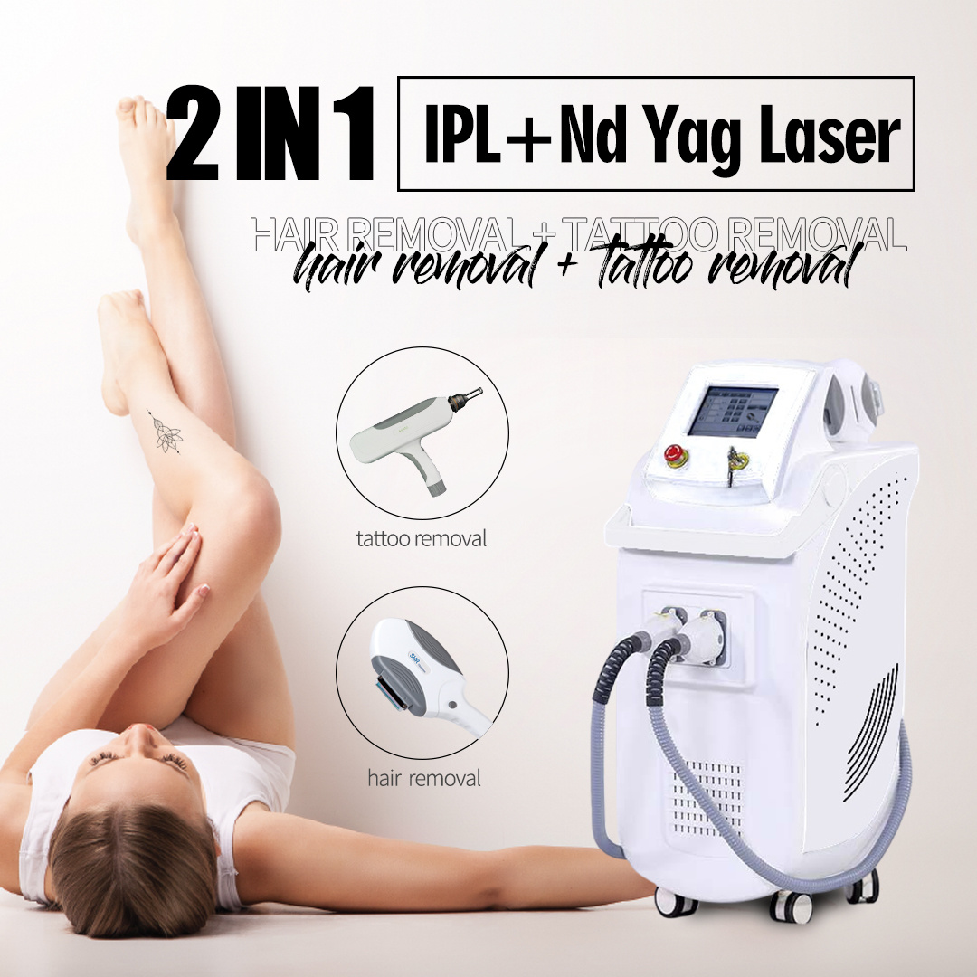 Yag laser hair removal store